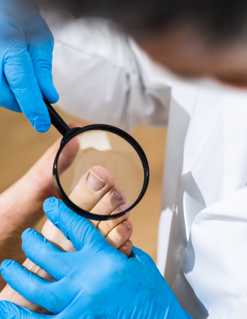 Causes of Curled Toenails | Red Mountain Footcare